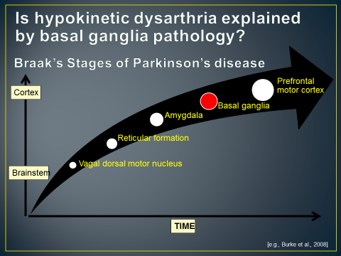 What Is Hypokinetic Dysarthria